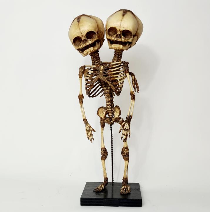 Human Skeletons | CURIOUS SCIENCE