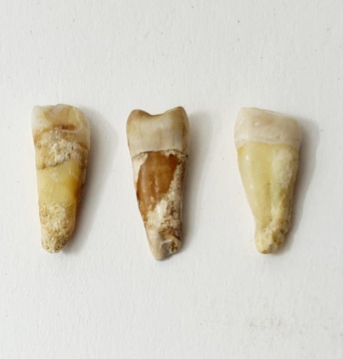 Incisor Human Teeth | CURIOUS SCIENCE