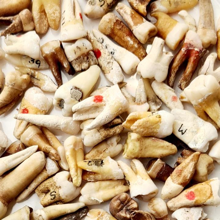 Human Teeth | CURIOUS SCIENCE