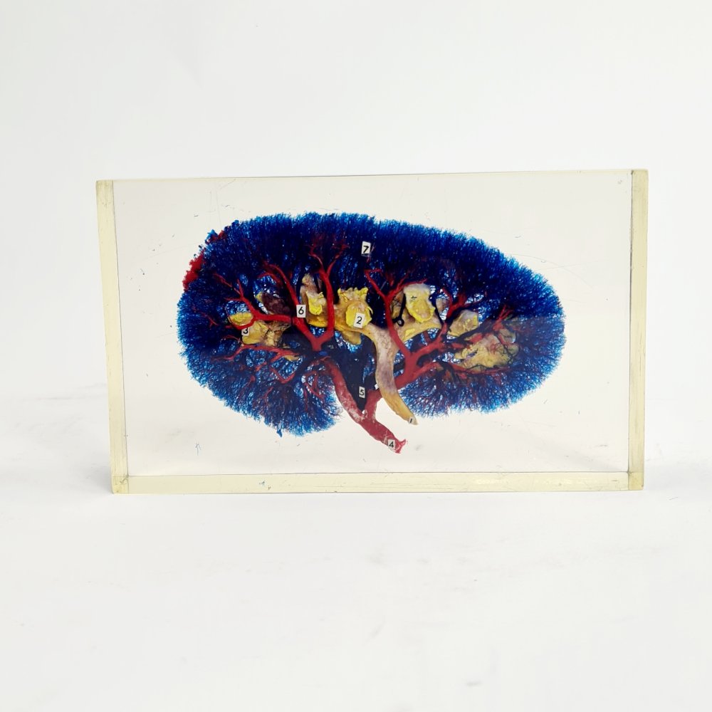 Kidney In Resin | CURIOUS SCIENCE