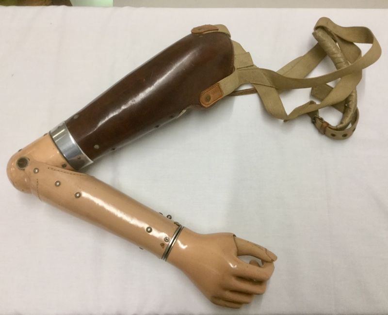 Prosthetic arm | CURIOUS SCIENCE