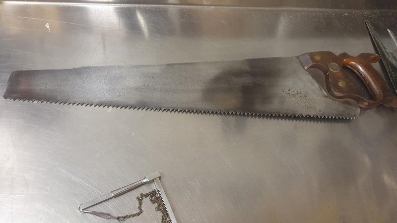 Retractor chain | CURIOUS SCIENCE